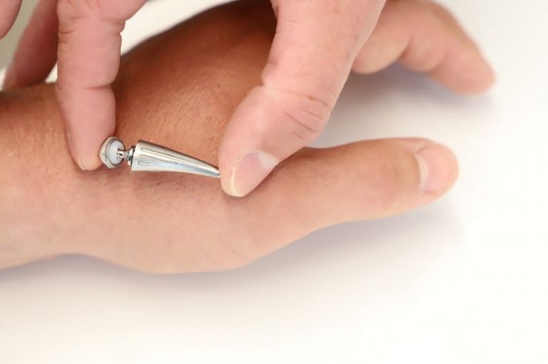 Rhizarthrose: Handchirurgen des Diakonie Klinikums setzen Mini-Prothese ...